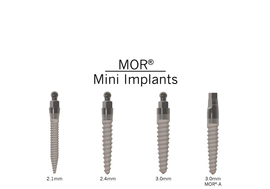Increased Practice Growth And Patient Satisfaction With The MOR® Mini ...